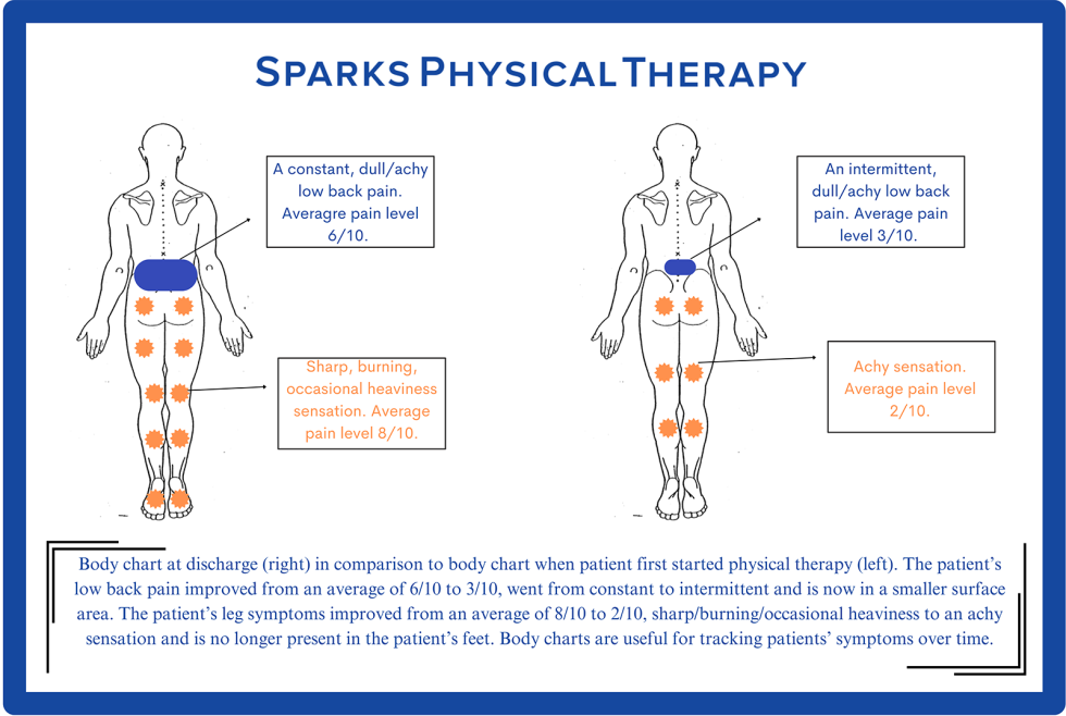 A Patient with Lumbar Spinal Stenosis – A Case Report | Sparks Physical ...